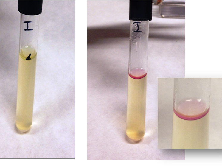 Docencia Microbiología UMHProducción de indol - Prácticas Microbiología UMH