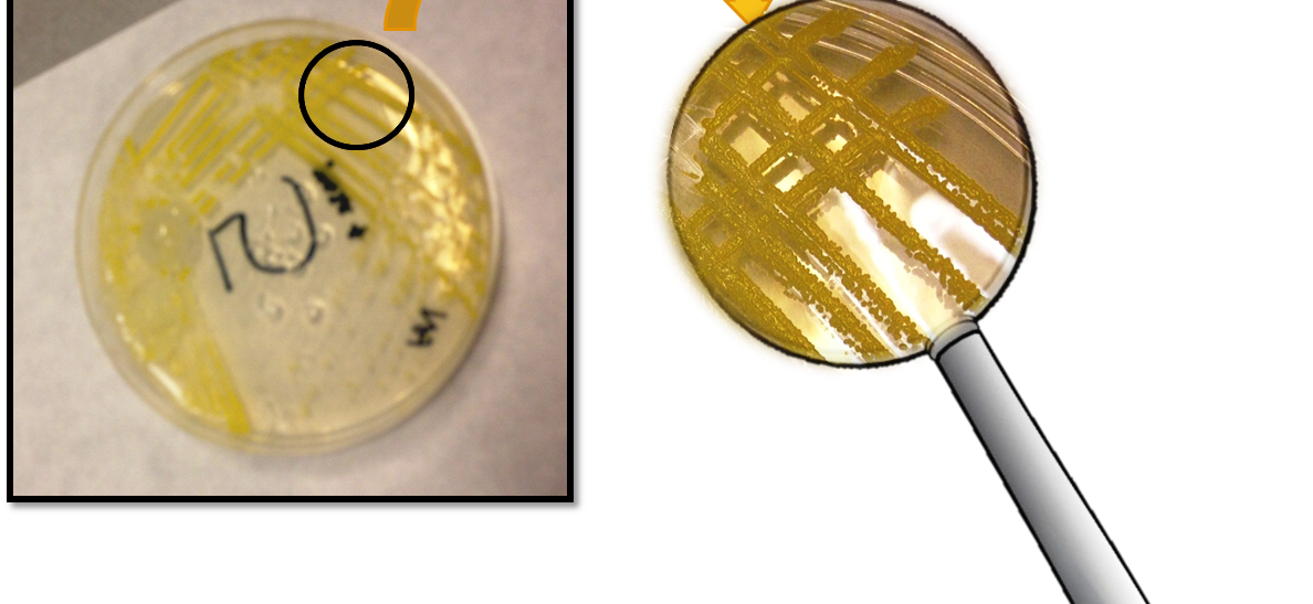 Microbiology Teaching UMHPigment production - MicroWeb UMH