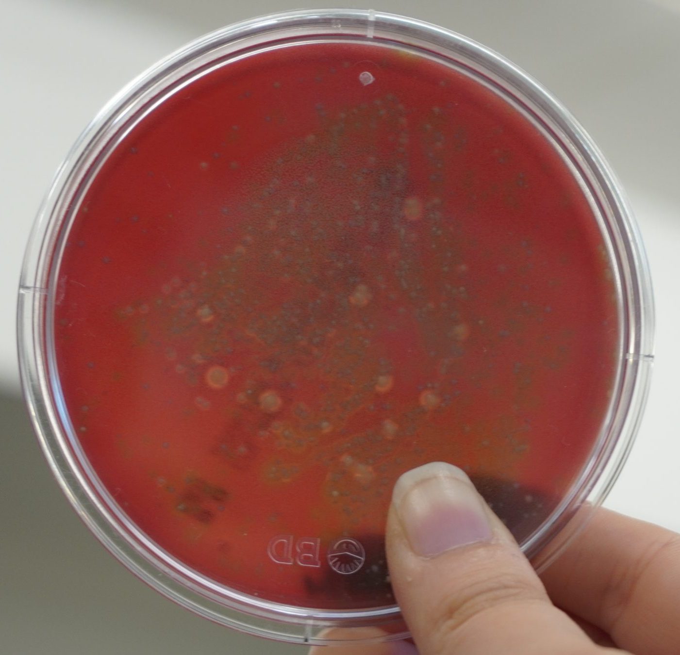 Docencia Microbiología UMHCapacidad hemolítica - Prácticas ...