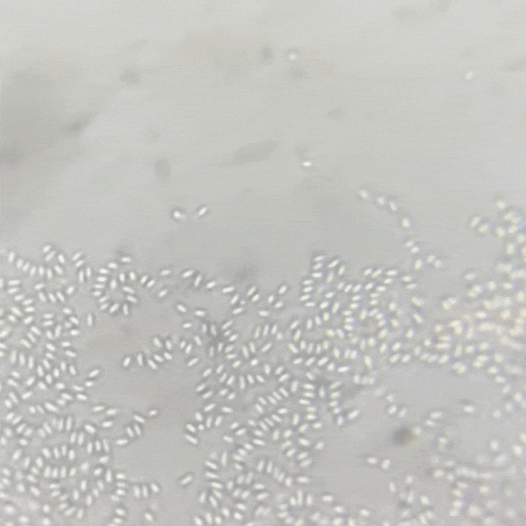 Docencia Microbiología UMHObservación en fresco - Prácticas ...