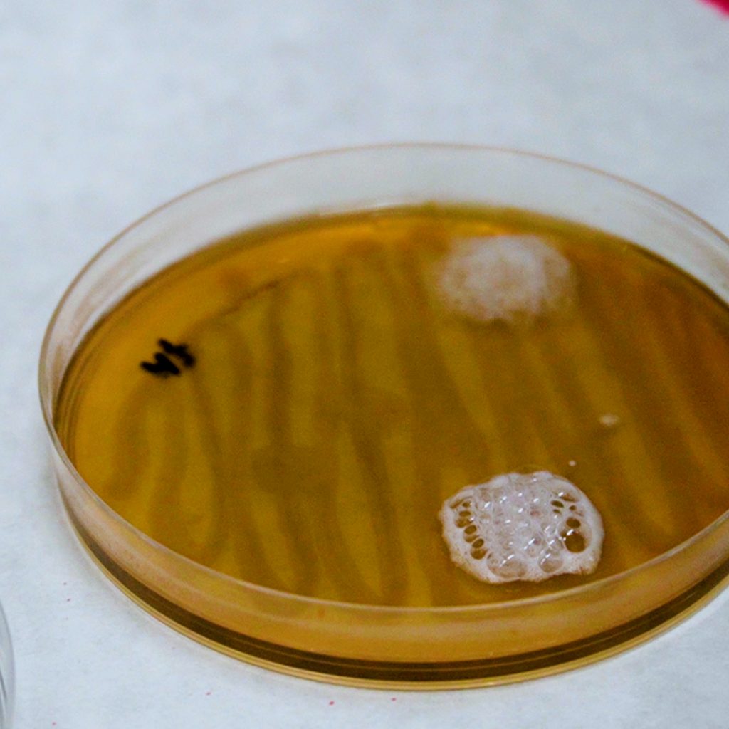 Docencia Microbiología UMHCatalasa - Prácticas Microbiología UMH