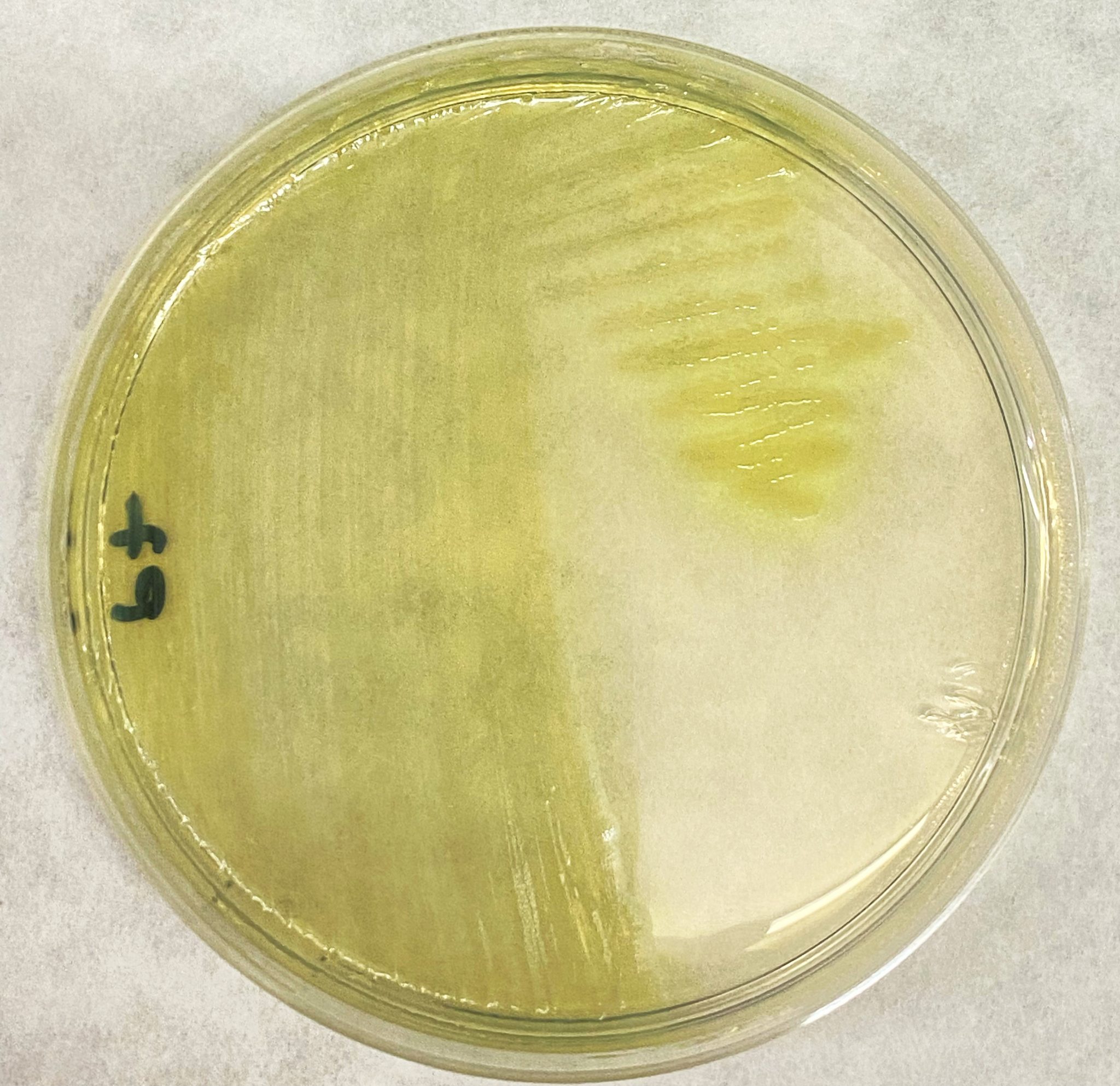 Microbiology Teaching UMHPigment production - MicroWeb UMH